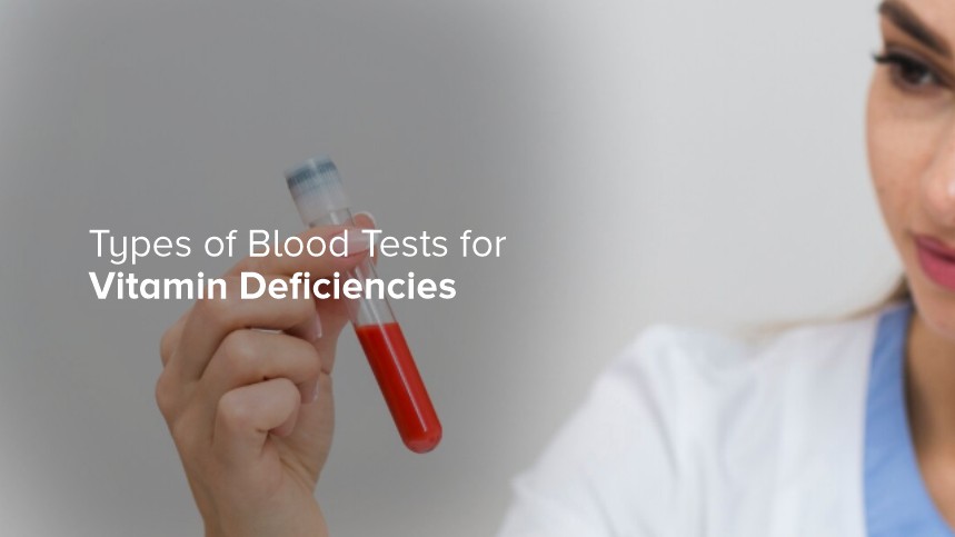 Types of Blood Tests for Vitamin Deficiencies