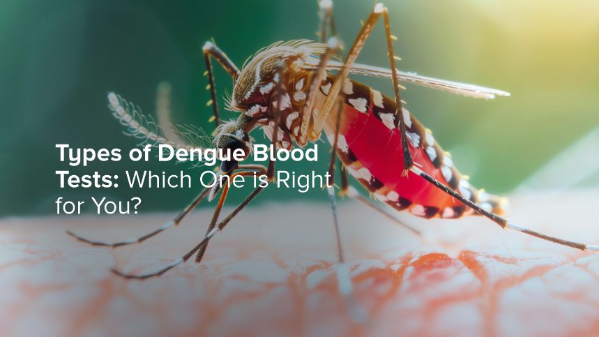 Types of Dengue Blood Tests: Which One is Right for You?