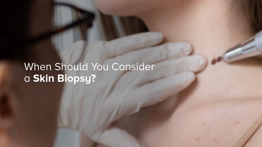 When You Should Consider a Skin Biopsy