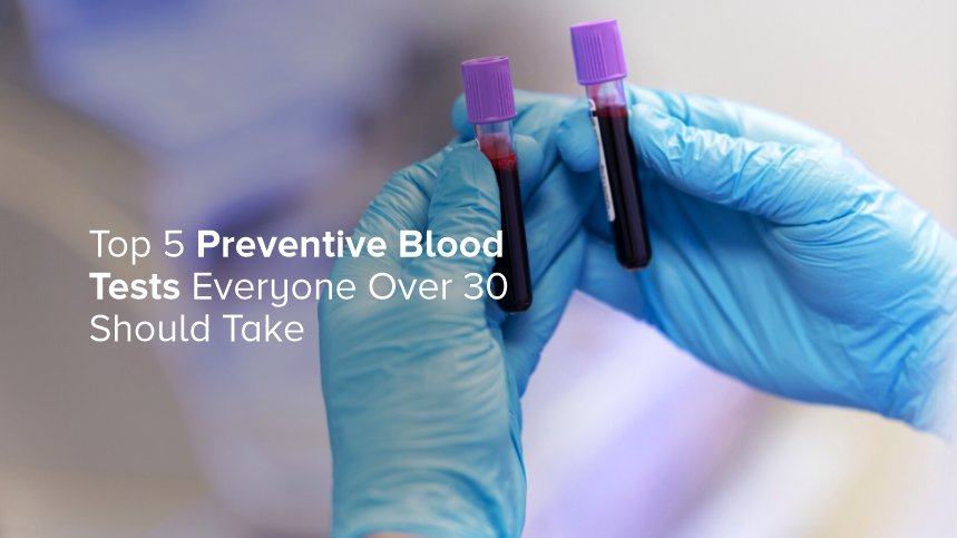 Top 5 Preventive Blood Tests Everyone Over 30 Must Take