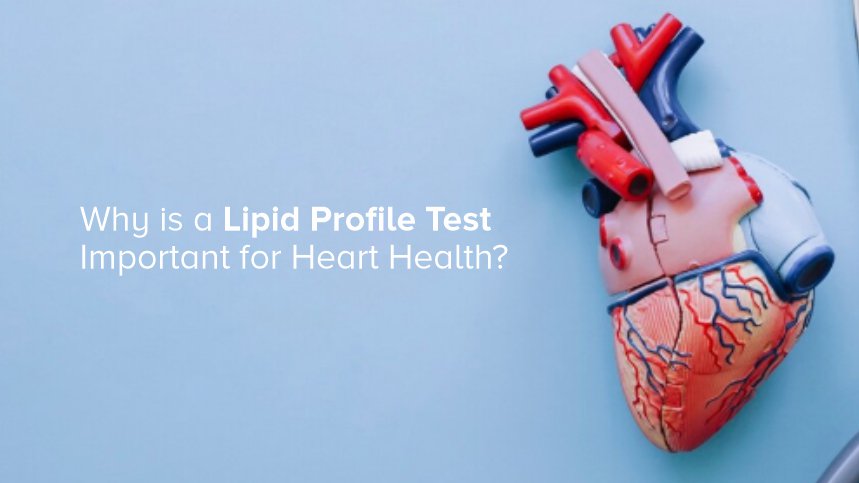 Why is a Lipid Profile Test Important for Heart Health?