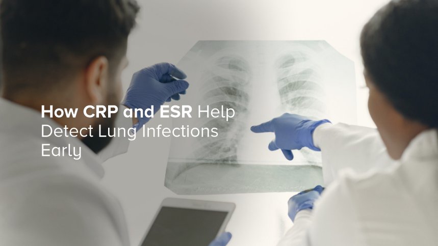 How CRP and ESR Help Detect Lung Infections Early
