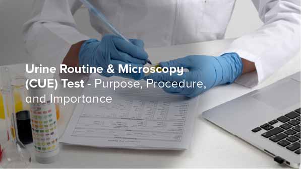 CUE Test Guide: Purpose, Procedure & Importance Explained