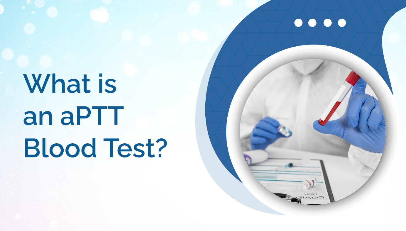 AMPATH Lab: What Is An Aptt Blood Test