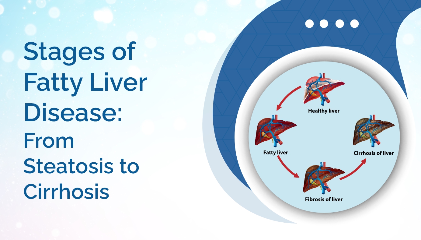 AMPATH Lab: Stages Of Fatty Liver Disease From Steatosis To Cirrhosis