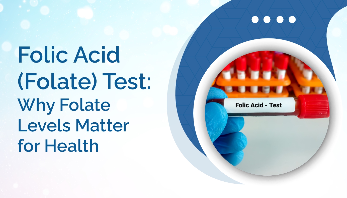 AMPATH Lab: Folic Acid Folate Test Why Folate Levels Matter Health