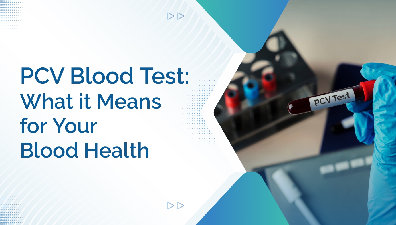 PCV Blood Test: What It Means for Your Blood Health